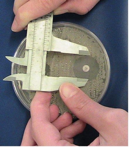 Zone Of Inhibition Explained