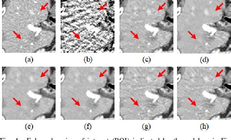 figure 4 from convolutional sparse coding for compressed sensing ct