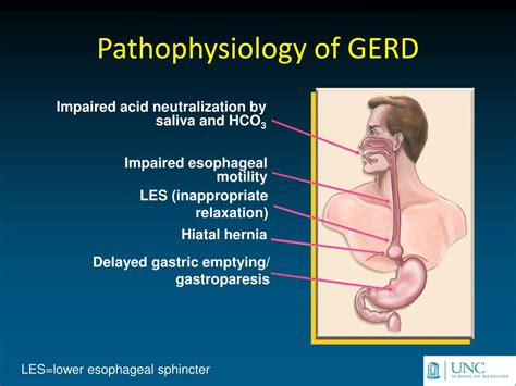 Ppt Gastroesophageal Reflux Disease And Barretts Esophagus
