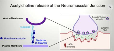 6 Lec 75 Tetanus Botulism Flashcards Quizlet