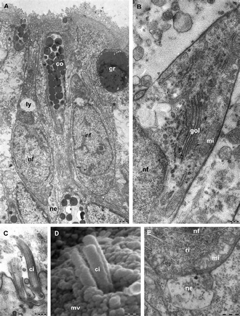 Fusiform Cells A Two Fusiform Cells Located Near The Tips Of