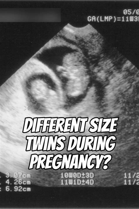 A Black And White Photo With The Words Different Size Twins During