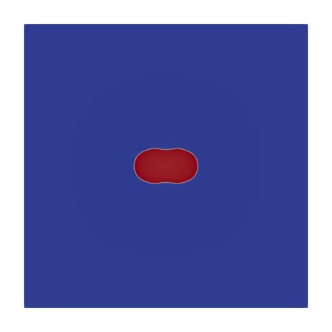 Time Evolution Of The Tumour ϕ For The Viscoelastic Model At Times T ∈ Download Scientific