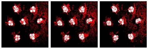 Image Processing — Blob Detection By Ralph Caubalejo Towards Data Science