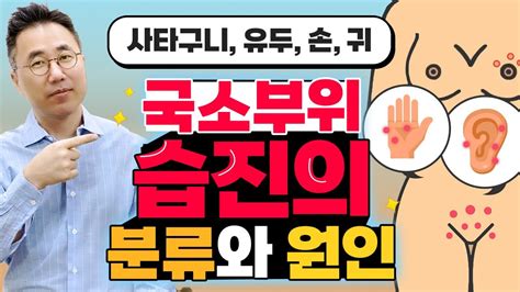 💥사타구니 유두 손 입술 겨드랑이 국소부위습진의 진단부터 잘못됐습니다 👉분류와 원인👈 구순염 유두습진 사타구니습진 Youtube