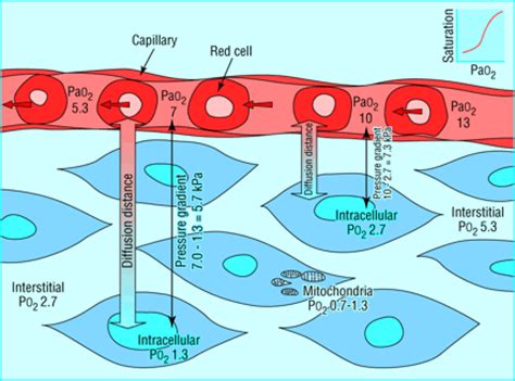 Oxygen Transport2 Tissue Hypoxia The Bmj