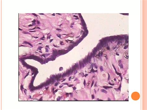 0102 Ambiguous Genitalia Case Presentationppt