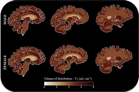 Exploratory Study Of Sex Differences In P‐glycoprotein Function At The