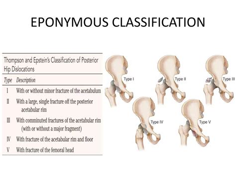 Fracture Aetiology Classification And Complicationspptx