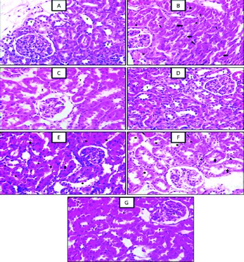 Effect Of Ellagic Acid Cilostazol And Their Combination On The