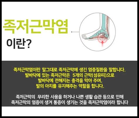 조은마디병원이 알려드리는 질환상식 족저근막염 건강정보 조은마디병원