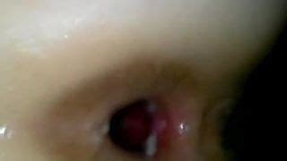 Nasty Amateur Anal Gape Compilation Free Porn Xhamster Xhamster