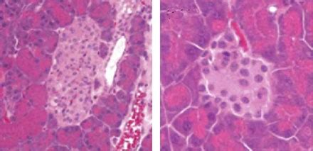 Beta Cells Forever Science AAAS