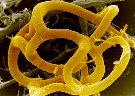 Arthrobotrys Oliospora Stock Image C009 4115 Science Photo Library