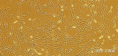 组胚学习笔记：结缔组织 知乎