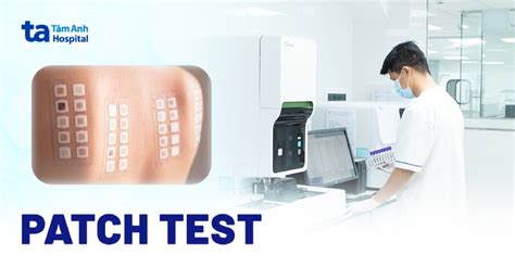 Patch Test Test áp Bì Là Gì Khi Nào Cần Thực Hiện