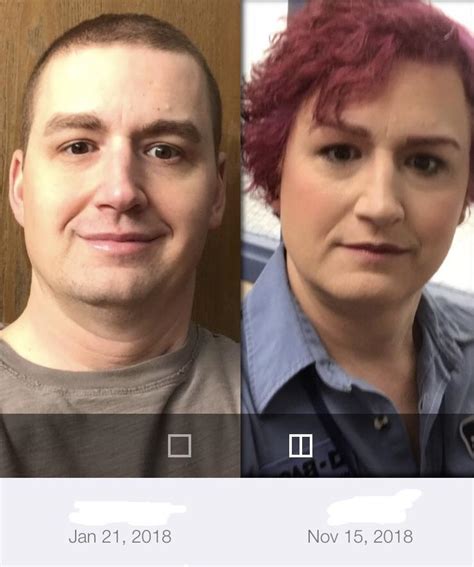 Newly Cracked Egg Vs 6 Months 8 Days Of Hrt Feeling Great About My