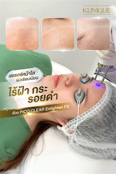 เลเซอร์หน้าใส ผิวเรียบเนียน ไร้ฝ้า กระ รอยดำ ด้วย Pico Clear Enlighten Fx Theklinique