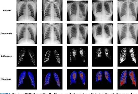 Figure 1 From Cyclegan Clinical Image Augmentation Based On Mask Self