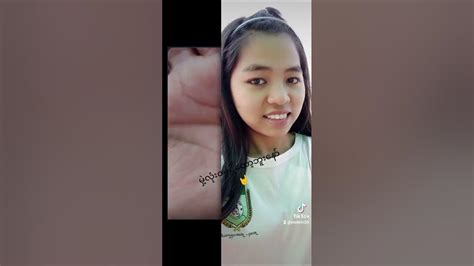 မှဲ့ဖျက် ကြွက်နို့ အသားပို ငါးမျက်စိ ဖျက်ဆေး စိန်သဘာဝအမာရွတ်မကျန်မှဲ့ဖ