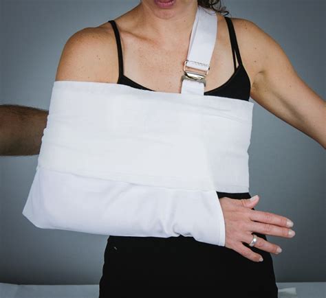 Upper Extremity Splints And Casts Musculoskeletal Key