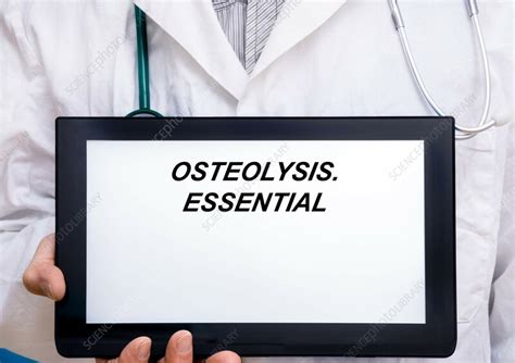 Osteolysis Conceptual Image Stock Image F037 1488 Science Photo Library