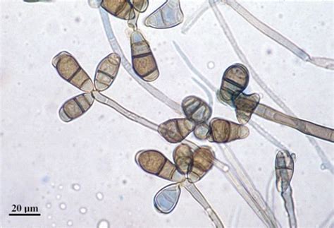 Lecture 4 Systemic Mycoses Flashcards Quizlet