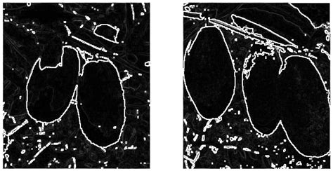 A Marker Controlled Watershed Algorithm For The Intelligent Picking Of Long Jujubes In Trees