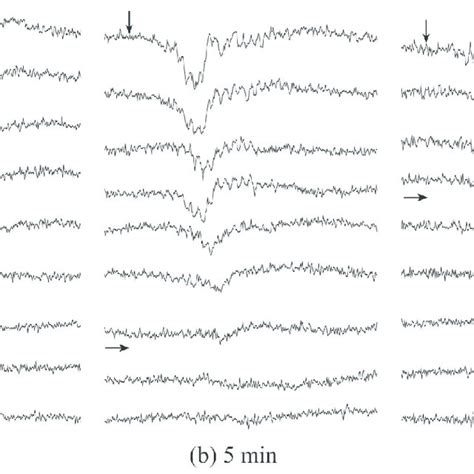 Abr Waveforms As A Function Of Stimulus Intensity Evoked By 1 Khz Tone Download Scientific
