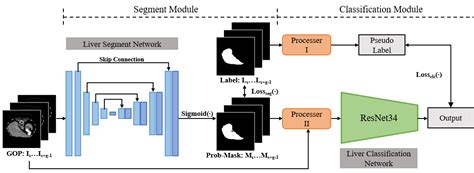 Github Chuizhao Liver Segmentation And Classification My Graduation