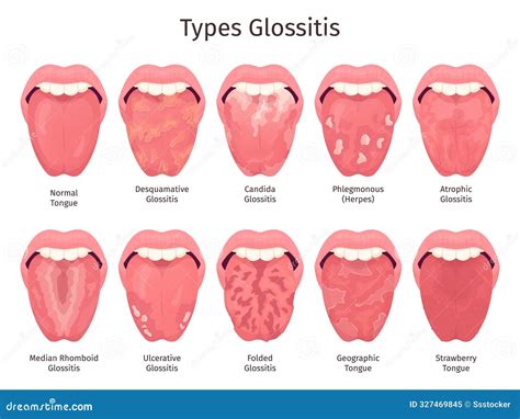 Uvula Sick With Limping Stick Cartoon Mascot Vector 245074780