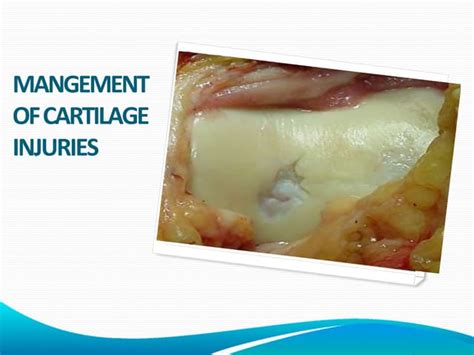 Management Of Cartilage Injuries Pptx Death Injury Or Military Conflict Sensitive Topics