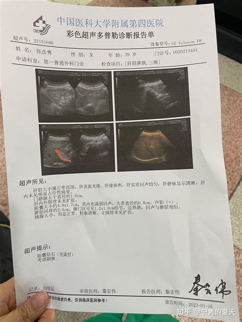 胆囊摘除 胆总管结石手术 记录（发病到术后第二天） 知乎