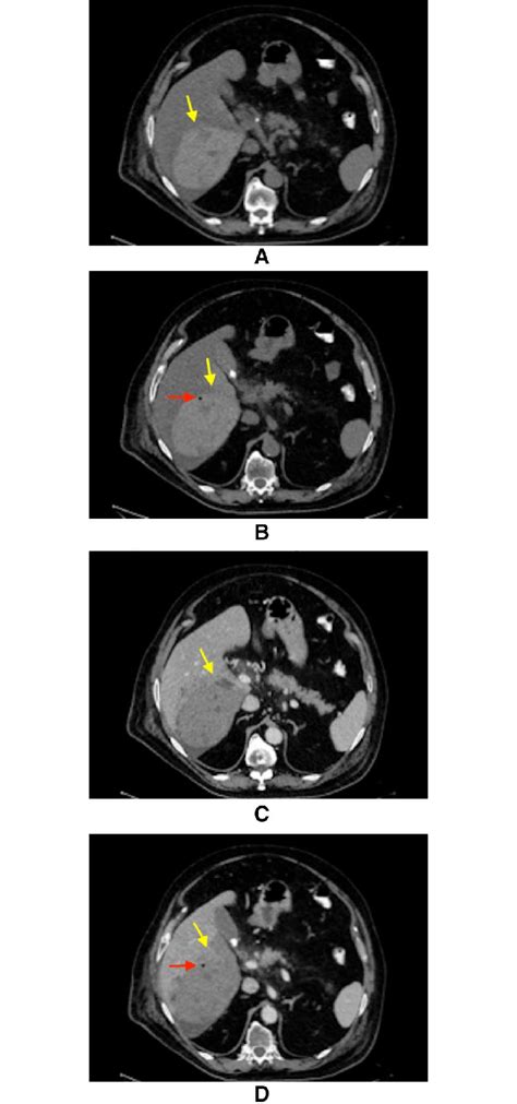 Different CT Sections With And Without Contrast Dye A CT Scan Showing Download Scientific