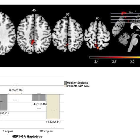 A Brain Regions Showing The Axial View Of The Cluster With