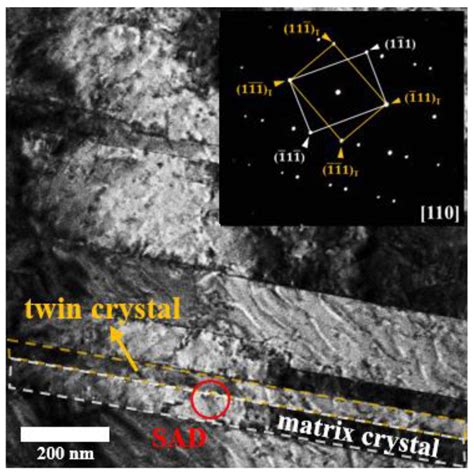 Bright Field Tem Image Showing The Microstructure Of Twin Grain
