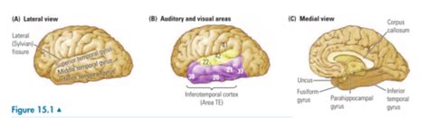 Ch 15 Temporal Lobes And Networks Flashcards Quizlet Ch 15 Temporal Lobes And Networks Flashcards Quizlet
