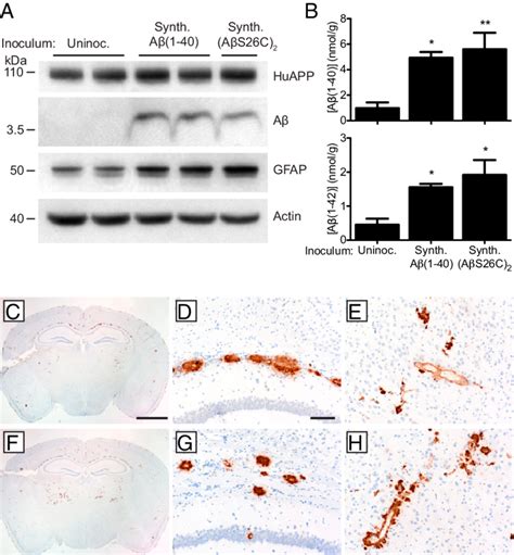 Induction Of Cerebral Aβ Deposition In Tg App23 Gfap Luc Mice Download Scientific Diagram