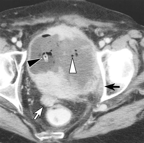 Imaging In The Diagnosis Staging And Follow Up Of Cancer Of The