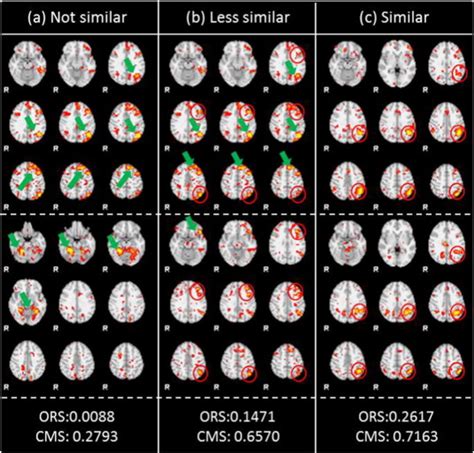 Examples Of Similarity Measurement Connectivity Map Similarity CMS Download Scientific