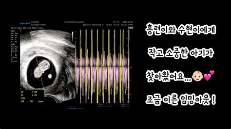 Vlog 그동안 영상을 올리지 못했던 이유 임신을 하게 되었어용 🤰🏻임신초기 입덧지옥 임밍아웃 임산부 브이로그 👶🏻