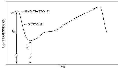 Figure 2 Calibration Free Pulse Oximetry Based On Two