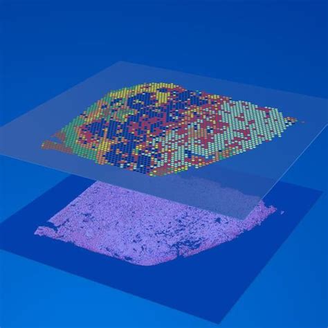 Visium Spatial Gene Expression Map Transcriptomes Within Tissue Context Technology Networks