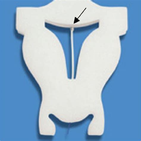 Classification Of Main Uterine Anomalies Adapted From Eshre Esge [12] Download Scientific