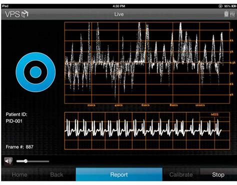 VPS G4 Pre Trial Education Console Images