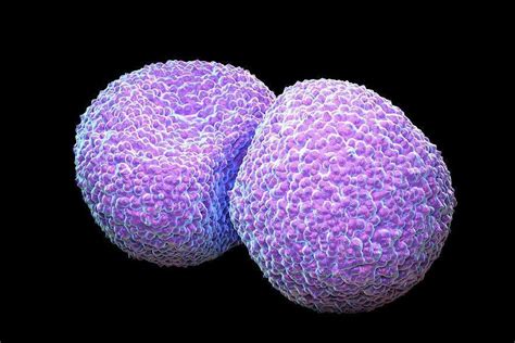 肺炎双球菌 搜狗百科