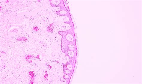 Tissue Engineering And Regenerative Medicine How To Regenerate Muscle And Bone The American