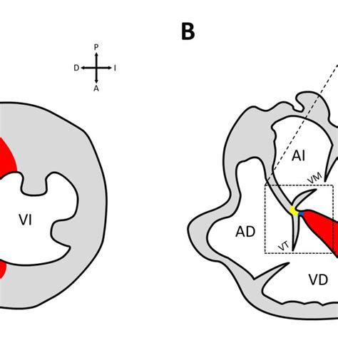 Tabique Interventricular A Sección Transversal Del Corazón Al Nivel Download Scientific Tabique Interventricular A Sección Transversal Del Corazón Al Nivel Download Scientific