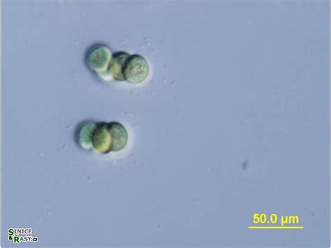 Limnococcus Limneticus Galerie