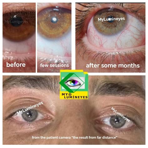 Best Eye Color Change